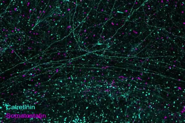 Technologies enable 3D imaging of whole human brain hemispheres at ...