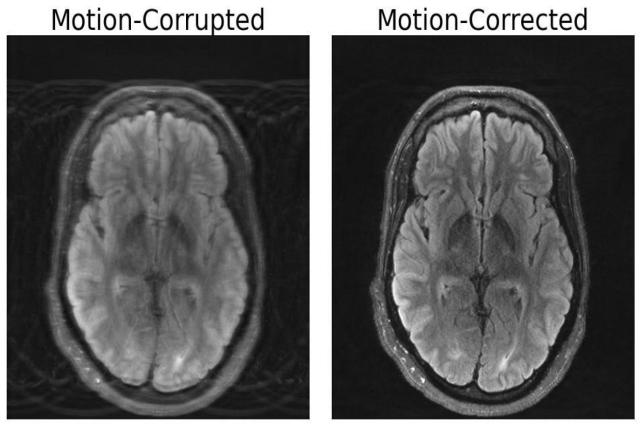 MIT researchers combine deep learning and physics to fix motion ...
